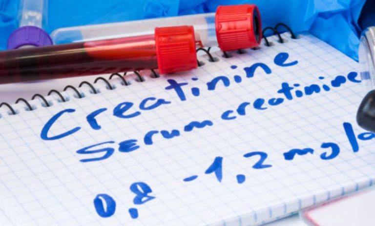¿Qué significa cuando la creatinina está alta? - Periodista Digital